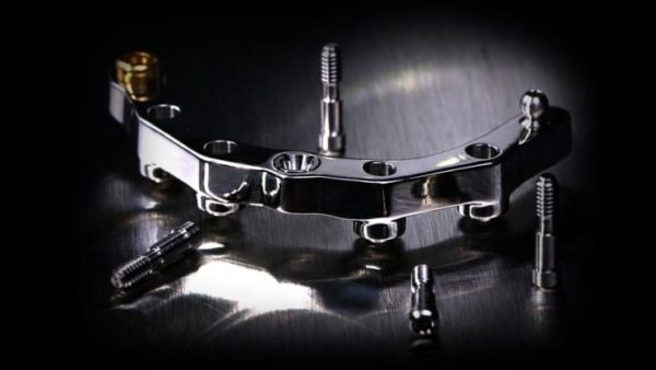 Bar Attachment Retained Overdenture | Keating Dental Lab