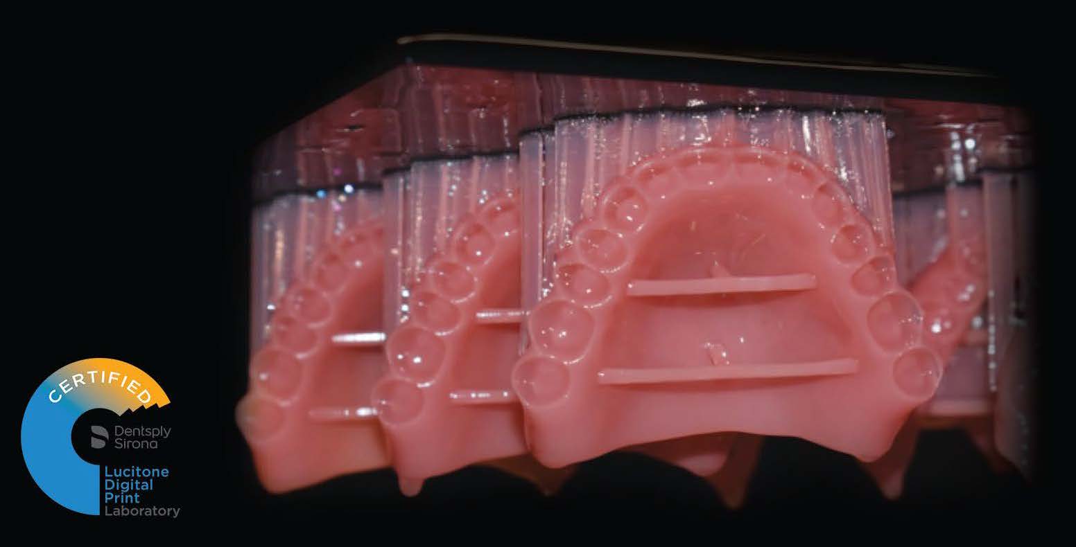 What are Digital Dentures: a Thorough Guide | Keating Dental Lab