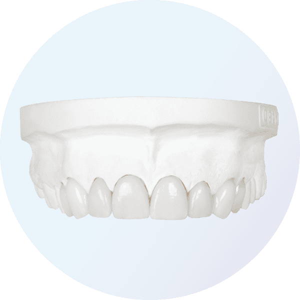 Emax Crowns: The Ultimate Guide - Keating Dental Lab