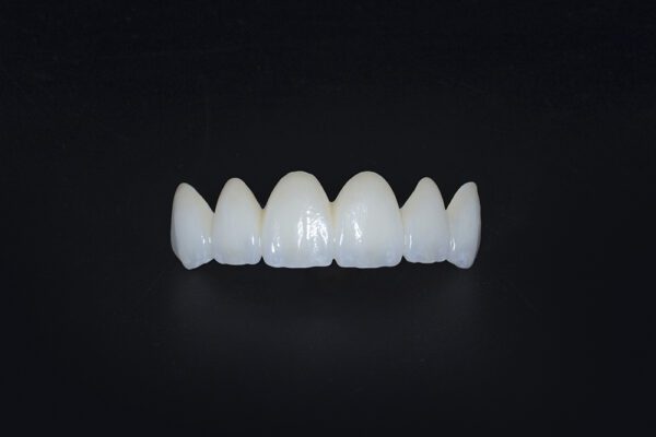KDZ Ultra® - Porcelain Fused to Zirconia Crown - PFZ Bridge